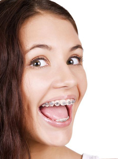 Braces | Jacksonville, AR | Cooper Family Dentistry